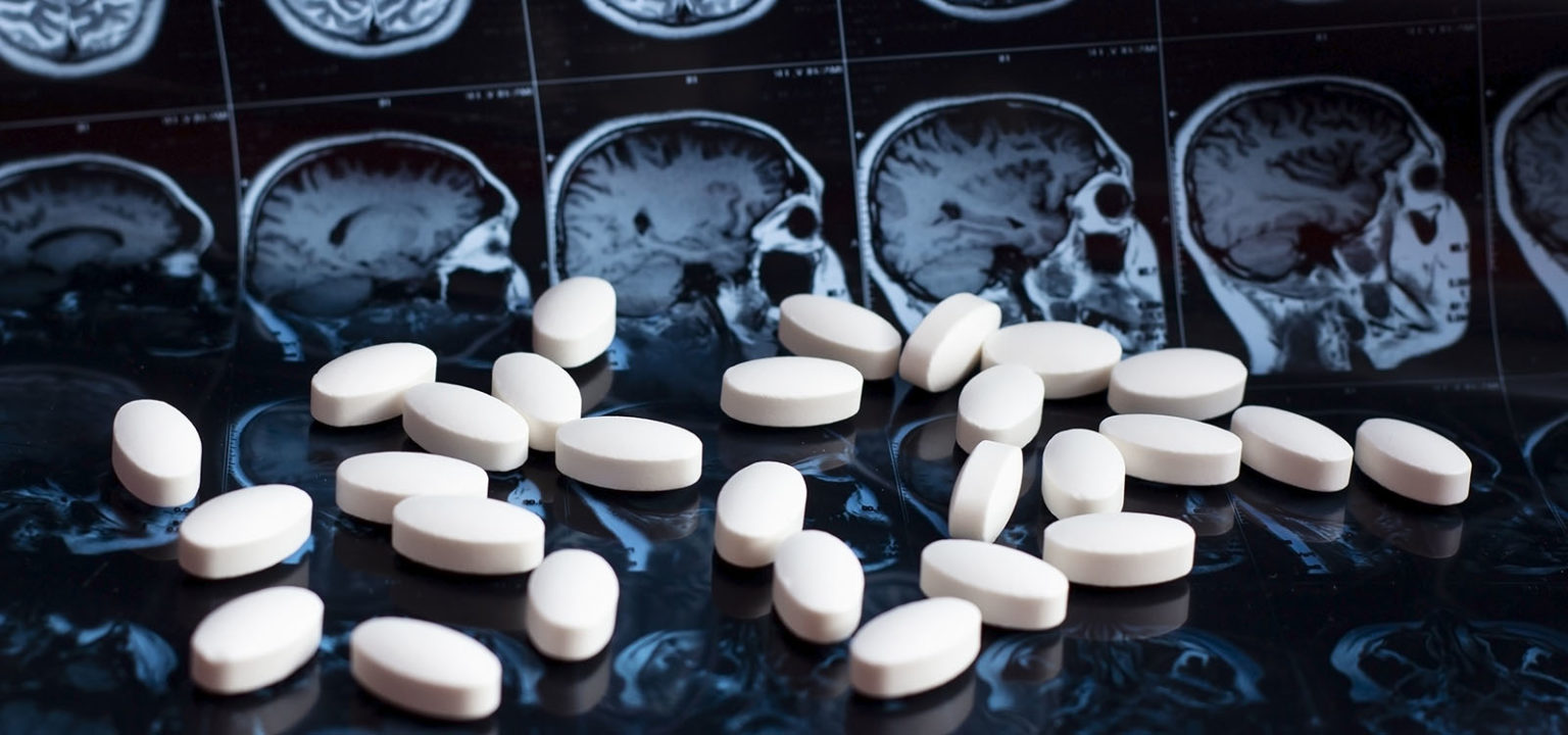 Benign is Not “Fine”: Common Misconceptions About Noncancerous Brain Tumors